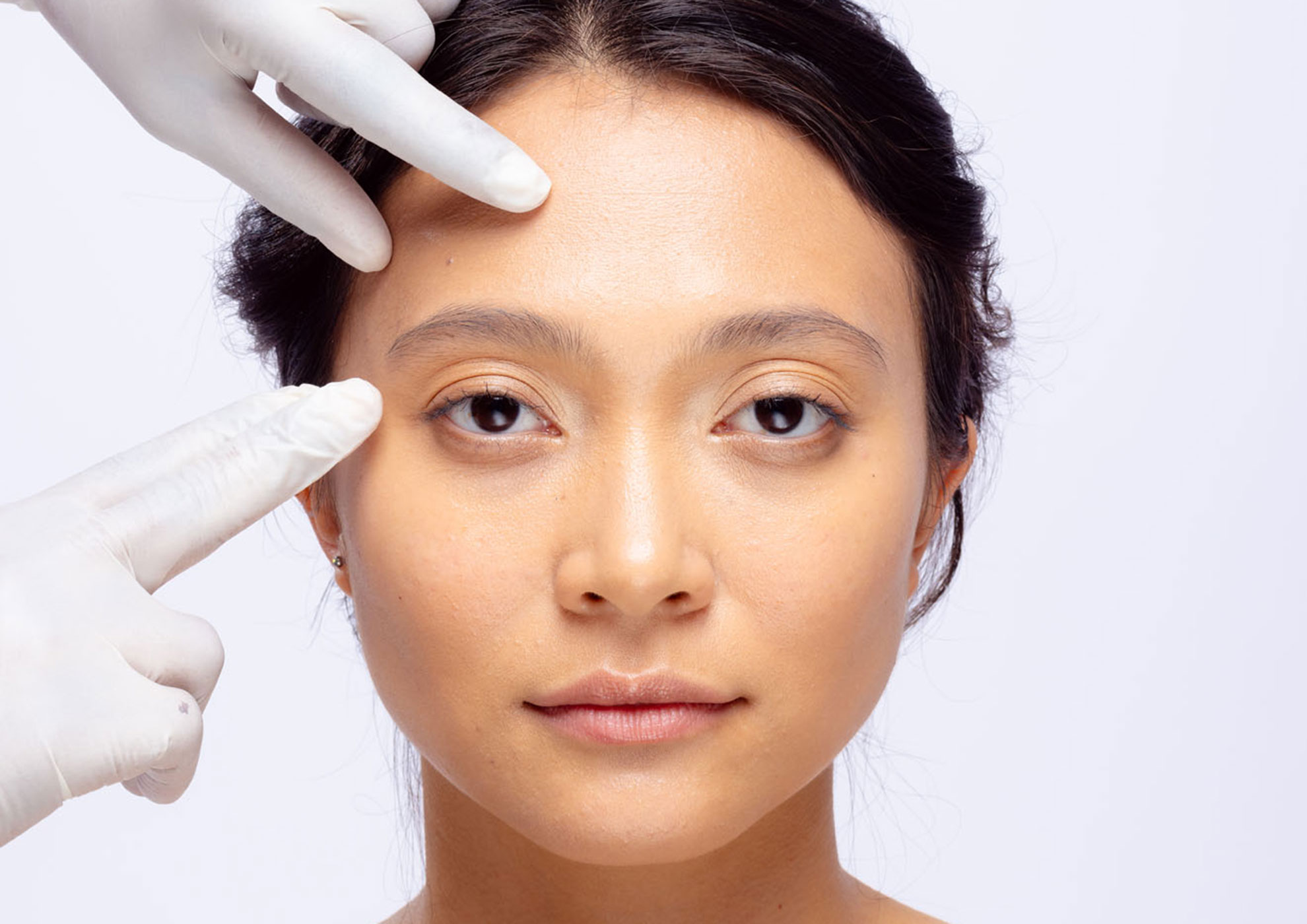 Brow Lift Treatments Cairns - Ageless Cosmetic Bar